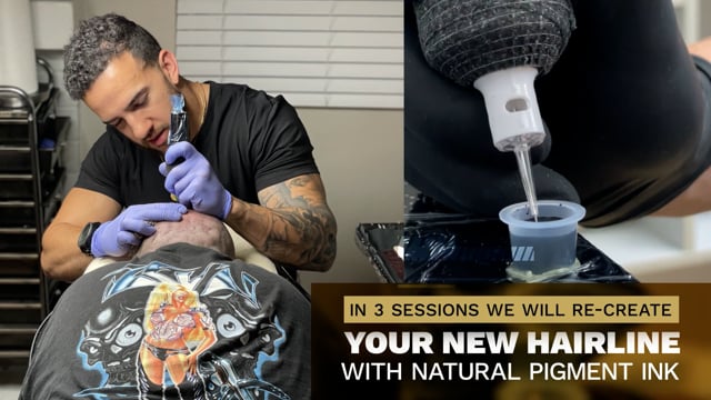 Results - Scalp Micro M3